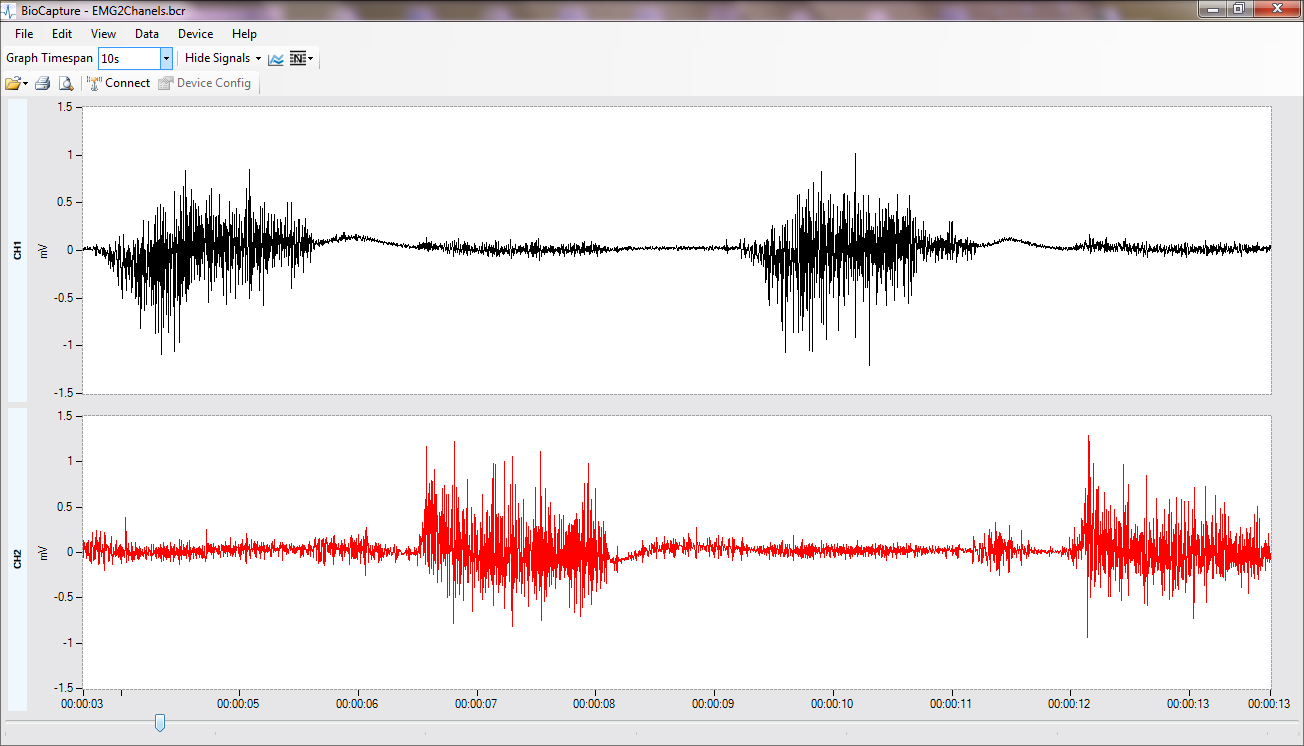 EMG – Great Lakes NeuroTechnologies