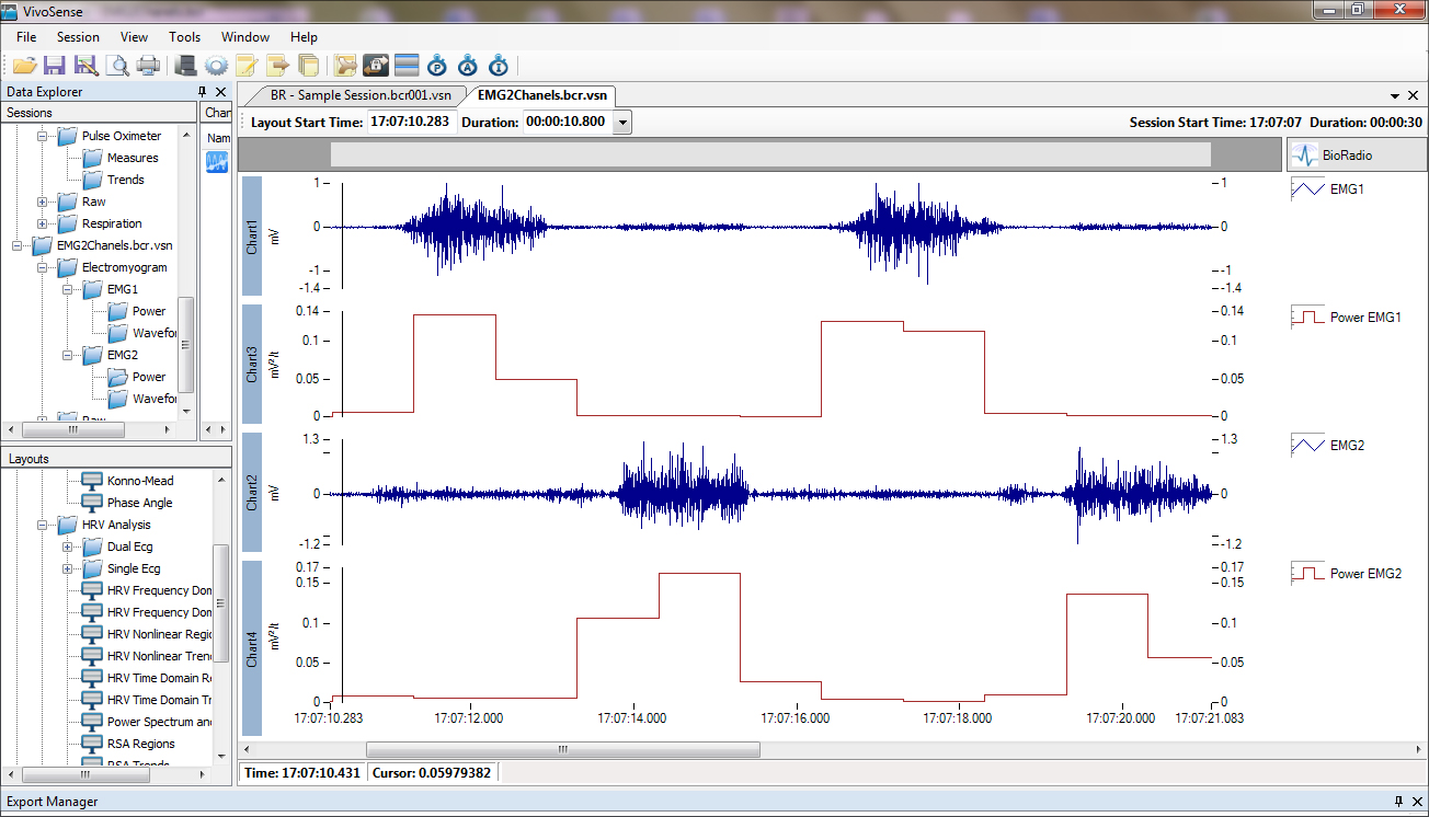 EMG – Great Lakes NeuroTechnologies
